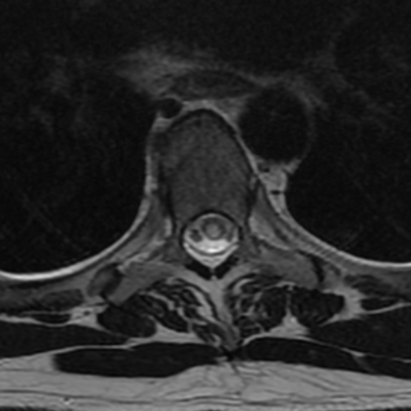 Case #11 - CaseStacks.com