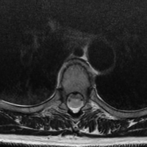 Case #19 - CaseStacks.com