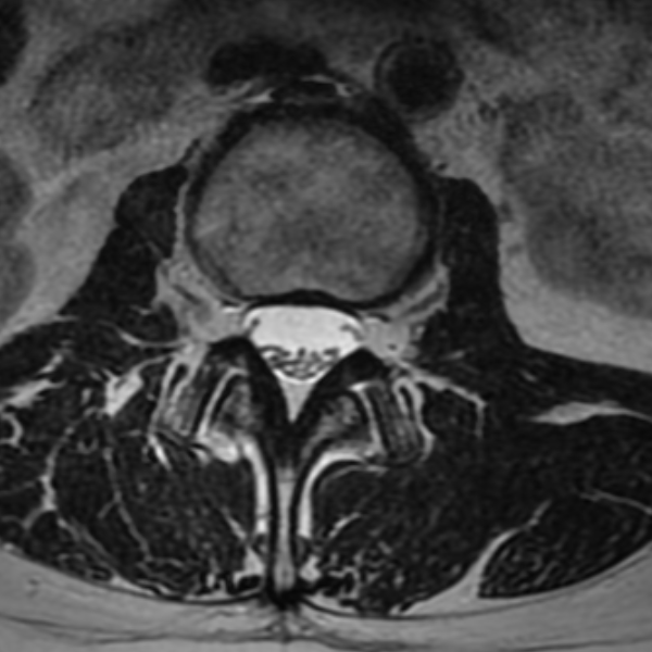 Case #21 - CaseStacks.com