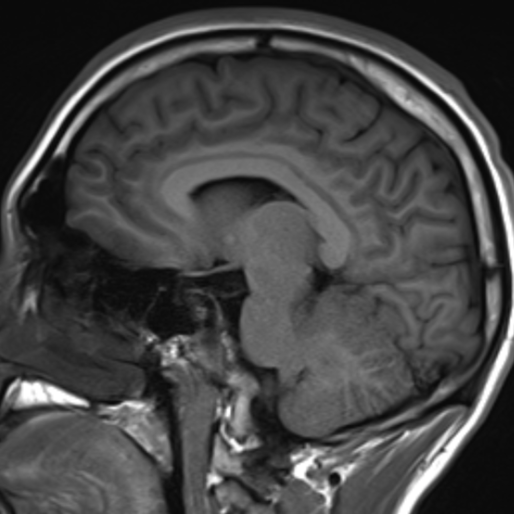 Case #49 - CaseStacks.com