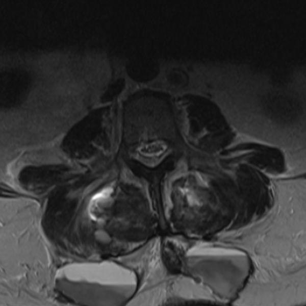 Case #6 - CaseStacks.com