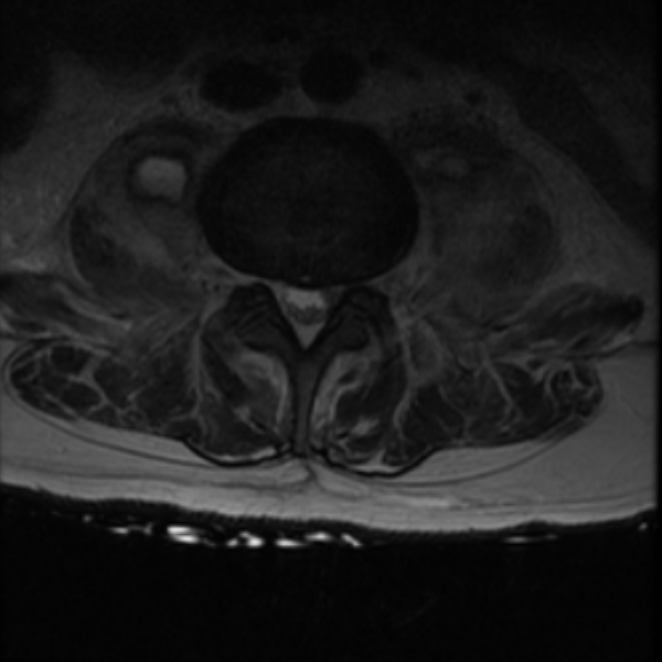 Case #8 - CaseStacks.com