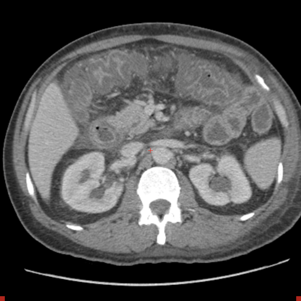 CaseStacks.com - Body CT Practice Cases