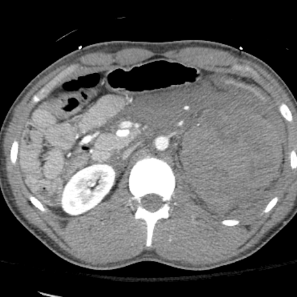 CaseStacks.com - Traumatic Body CT Cases