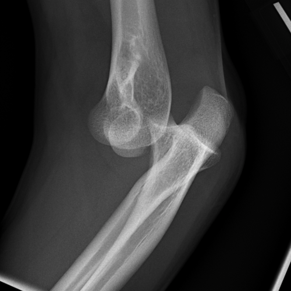 CaseStacks.com - Interactive Elbow Radiograph Cases