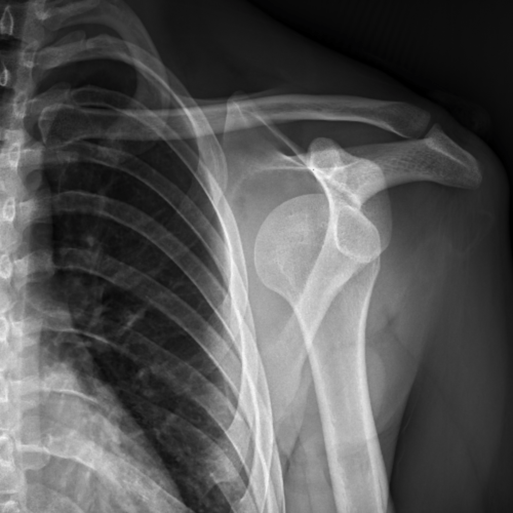 CaseStacks.com - MSK Radiographs