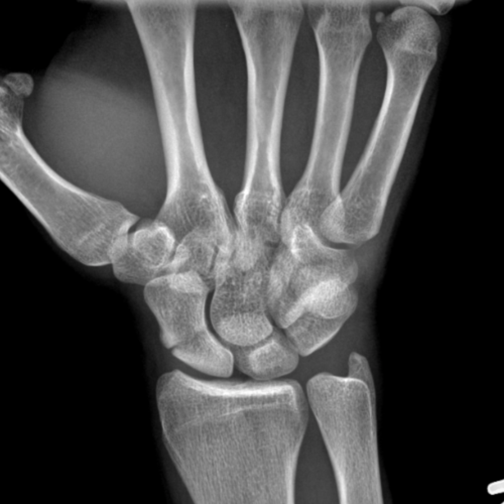 CaseStacks.com - Interactive Wrist & Hand Radiograph Cases