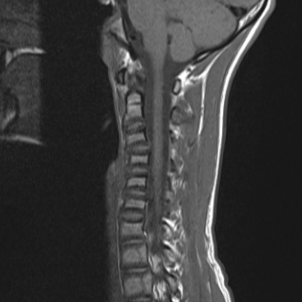 CaseStacks.com - Interactive Spine MRI Cases