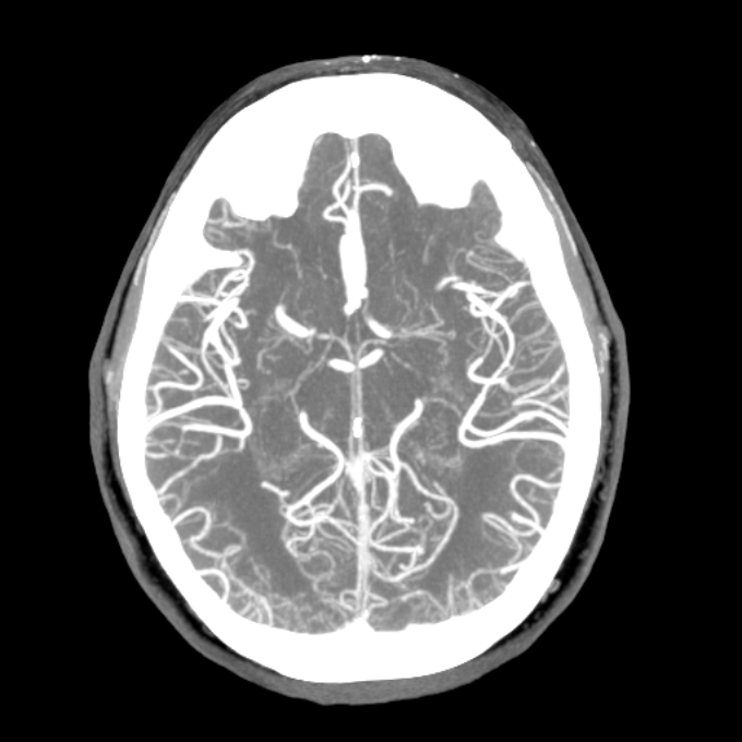 Case #30 - CaseStacks.com