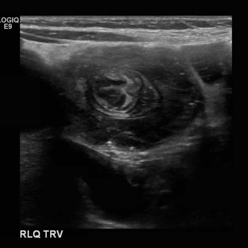 Case #11 - CaseStacks.com