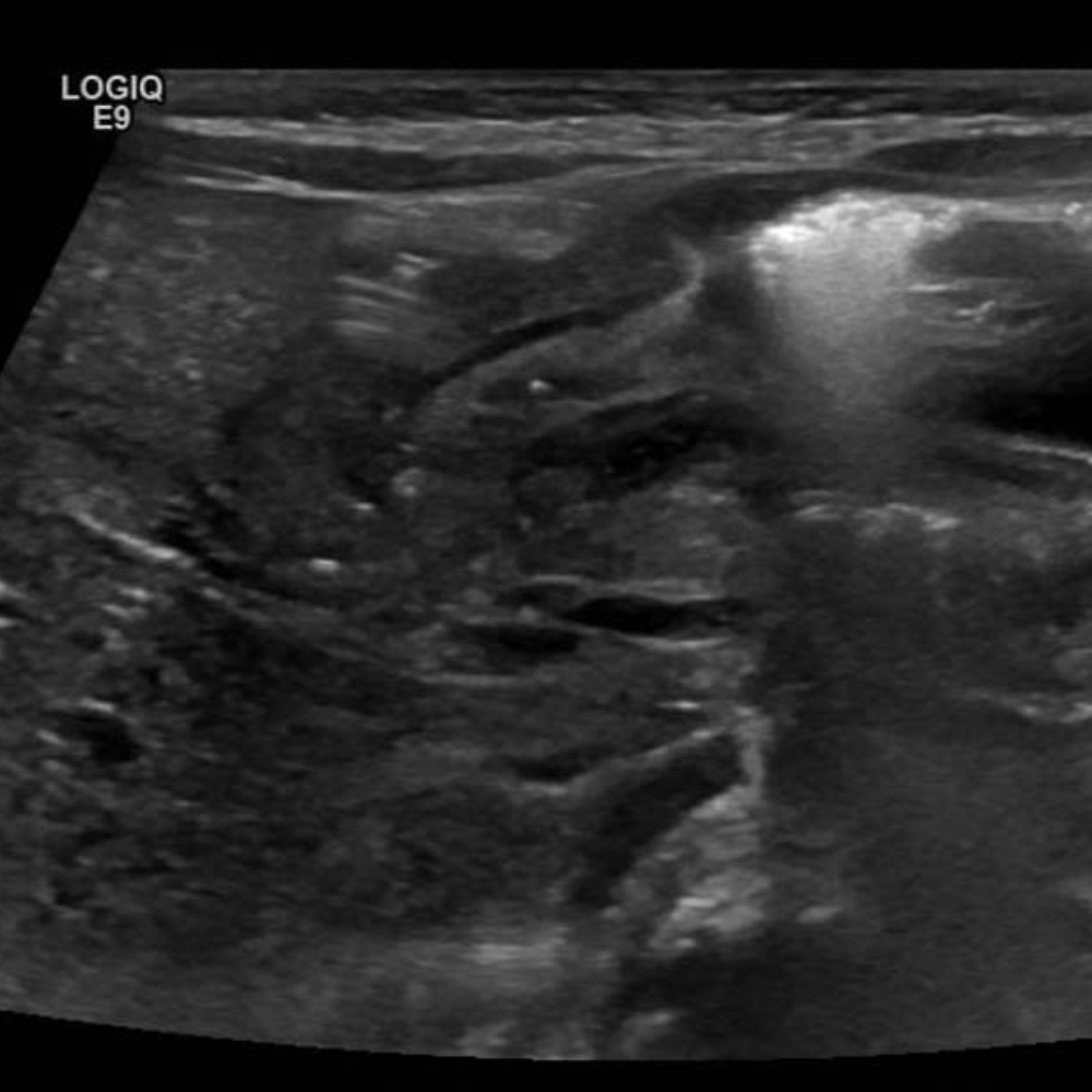 Case #12 - CaseStacks.com