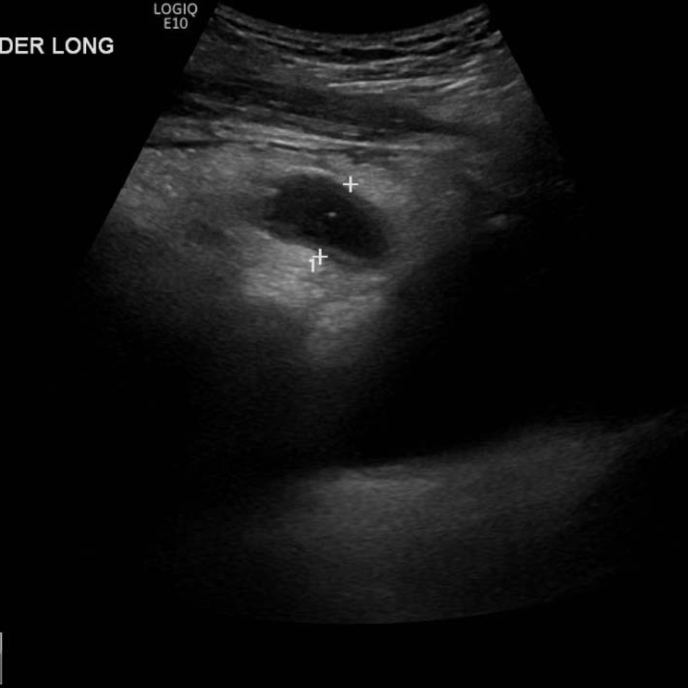 Case #12 - CaseStacks.com