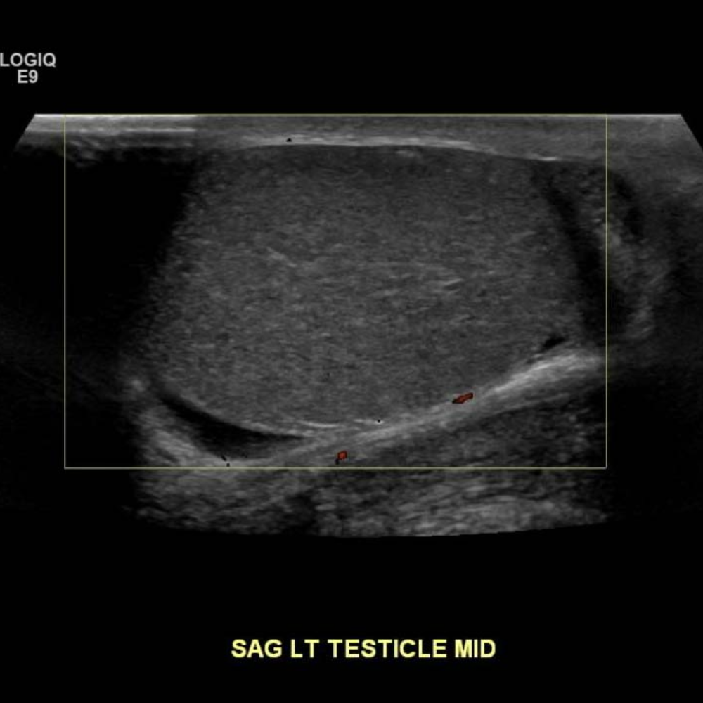 Case #13 - CaseStacks.com