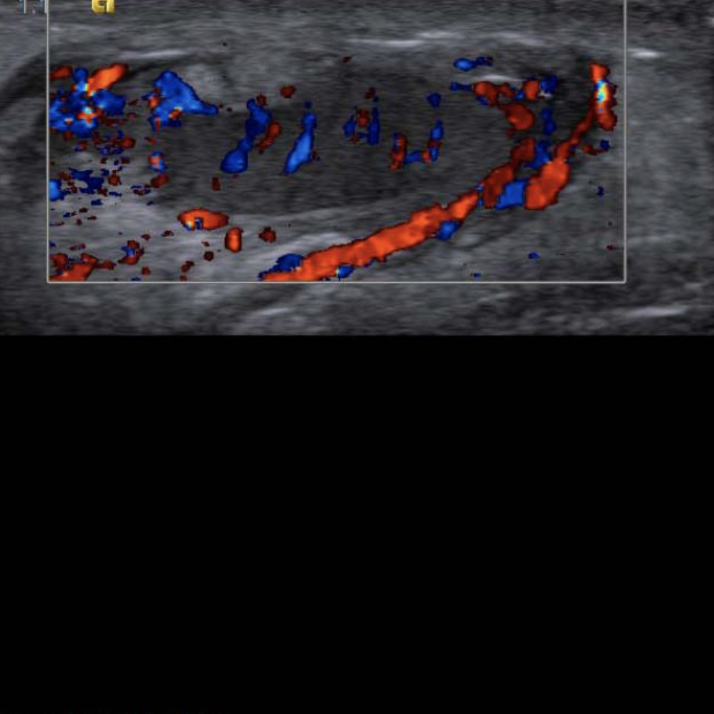 Case #14 - CaseStacks.com