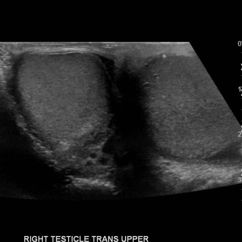 Case #15 - CaseStacks.com