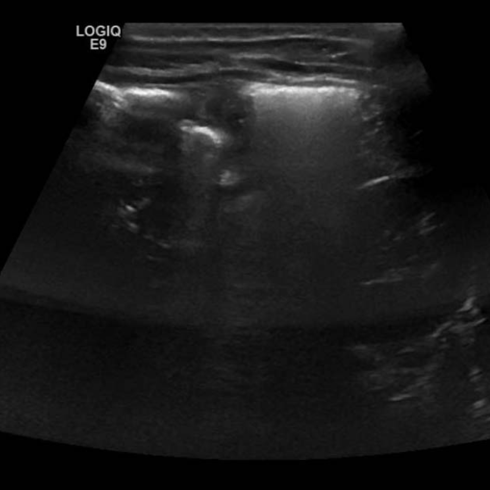 Case #2 - CaseStacks.com