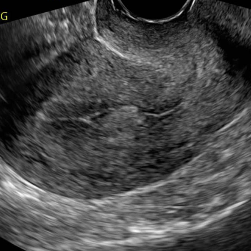 Case #28 - CaseStacks.com