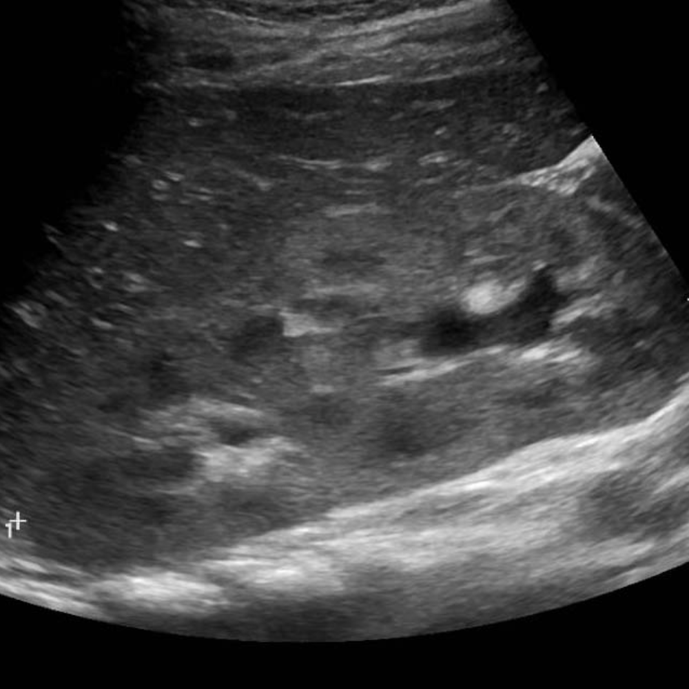 Case #3 - CaseStacks.com