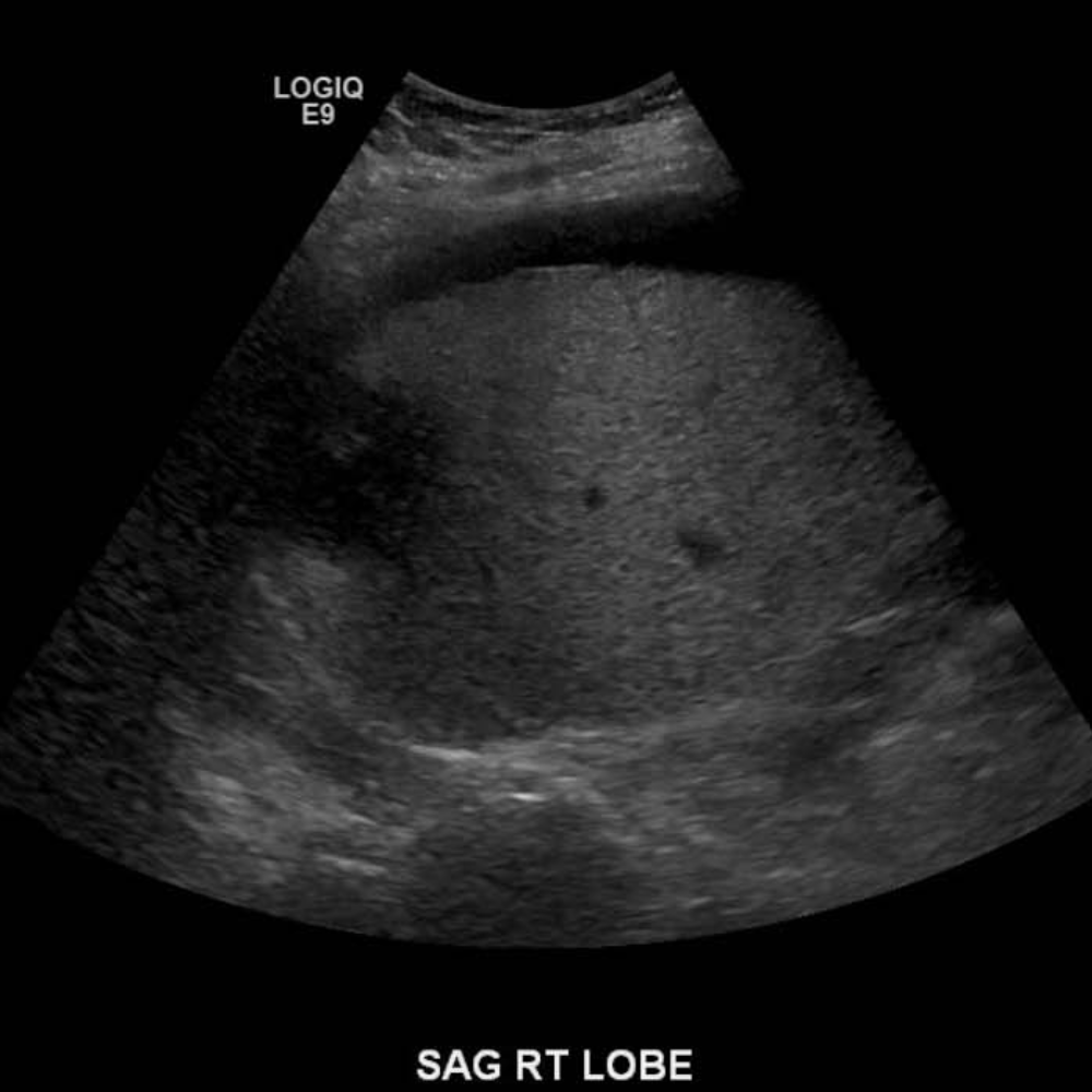 Case #3 - CaseStacks.com