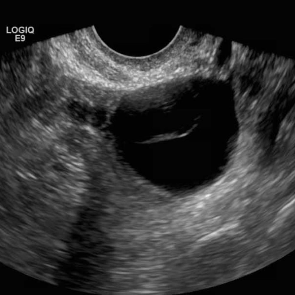 Case #32 - CaseStacks.com