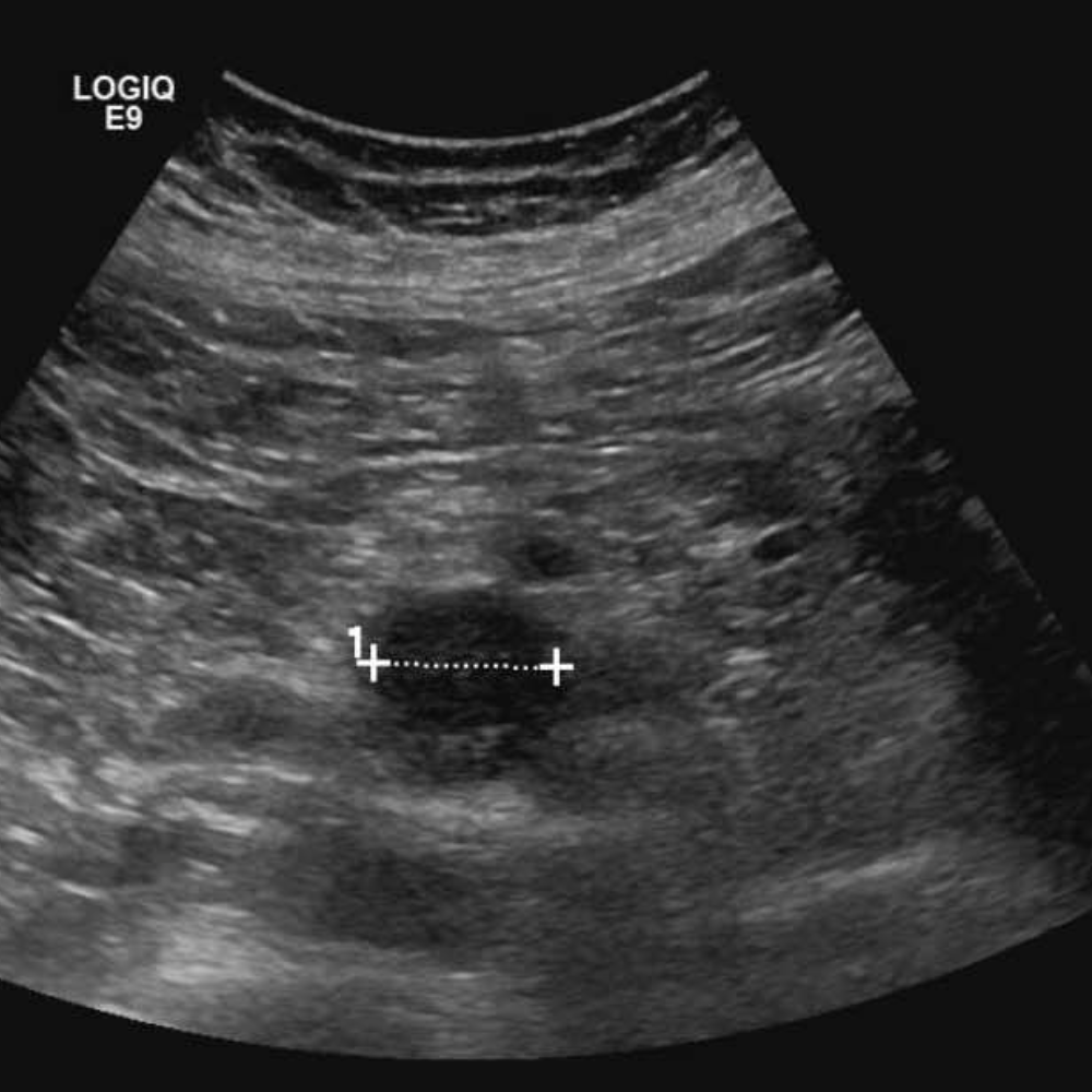 Case #37 - CaseStacks.com