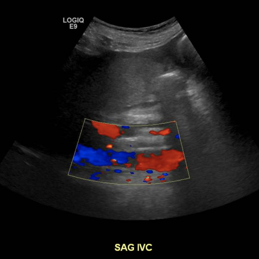 Case #4 - CaseStacks.com