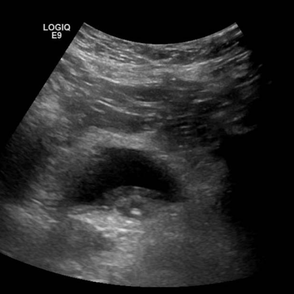 Case #41 - CaseStacks.com