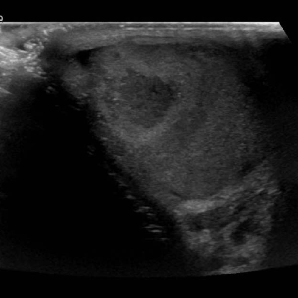 Case #5 - CaseStacks.com