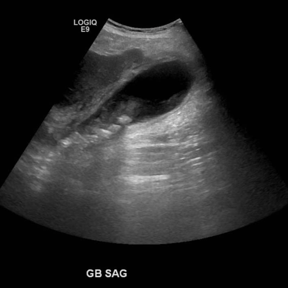 Case #5 - CaseStacks.com
