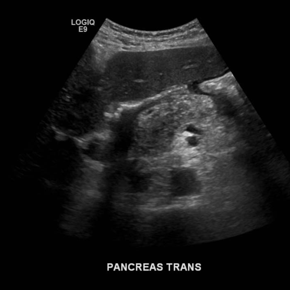Case #7 - CaseStacks.com
