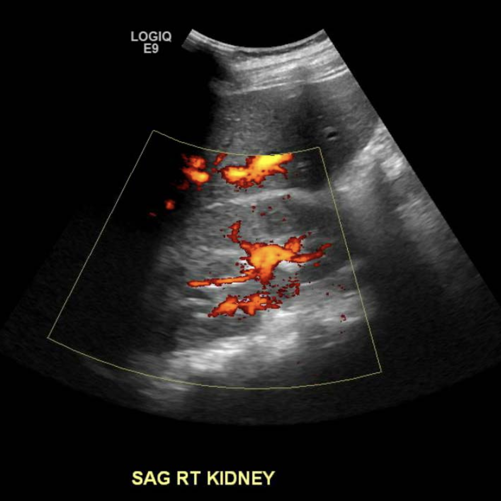 Case #8 - CaseStacks.com