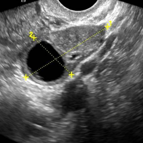 Case #20 - CaseStacks.com