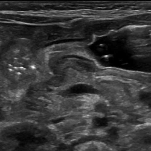 Case #13 - CaseStacks.com