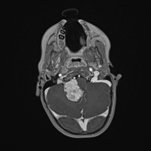 Case #12 - CaseStacks.com