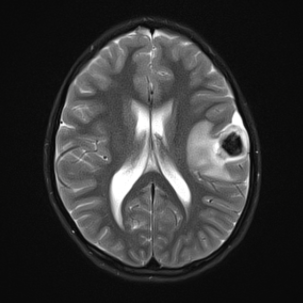 Case #14 - CaseStacks.com