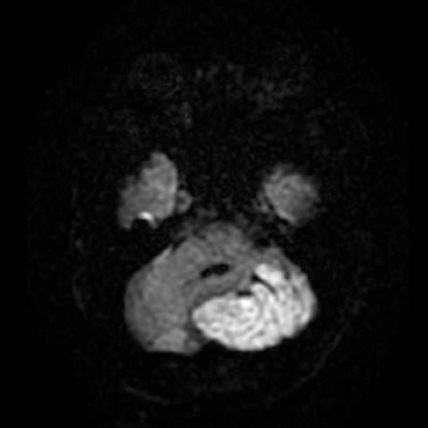 Case #19 - CaseStacks.com