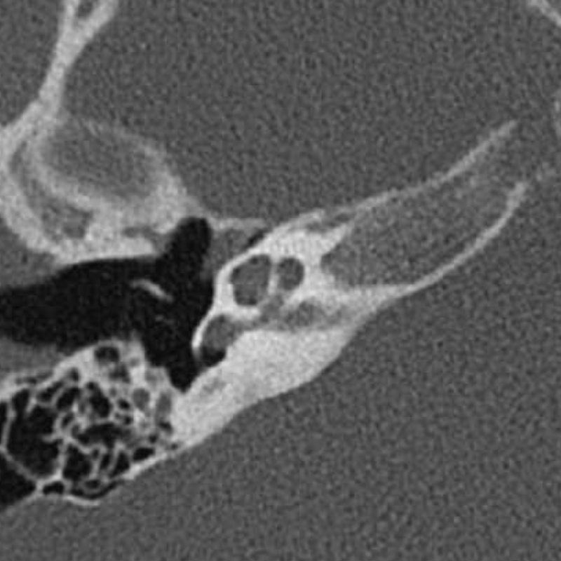 Case #12 - CaseStacks.com