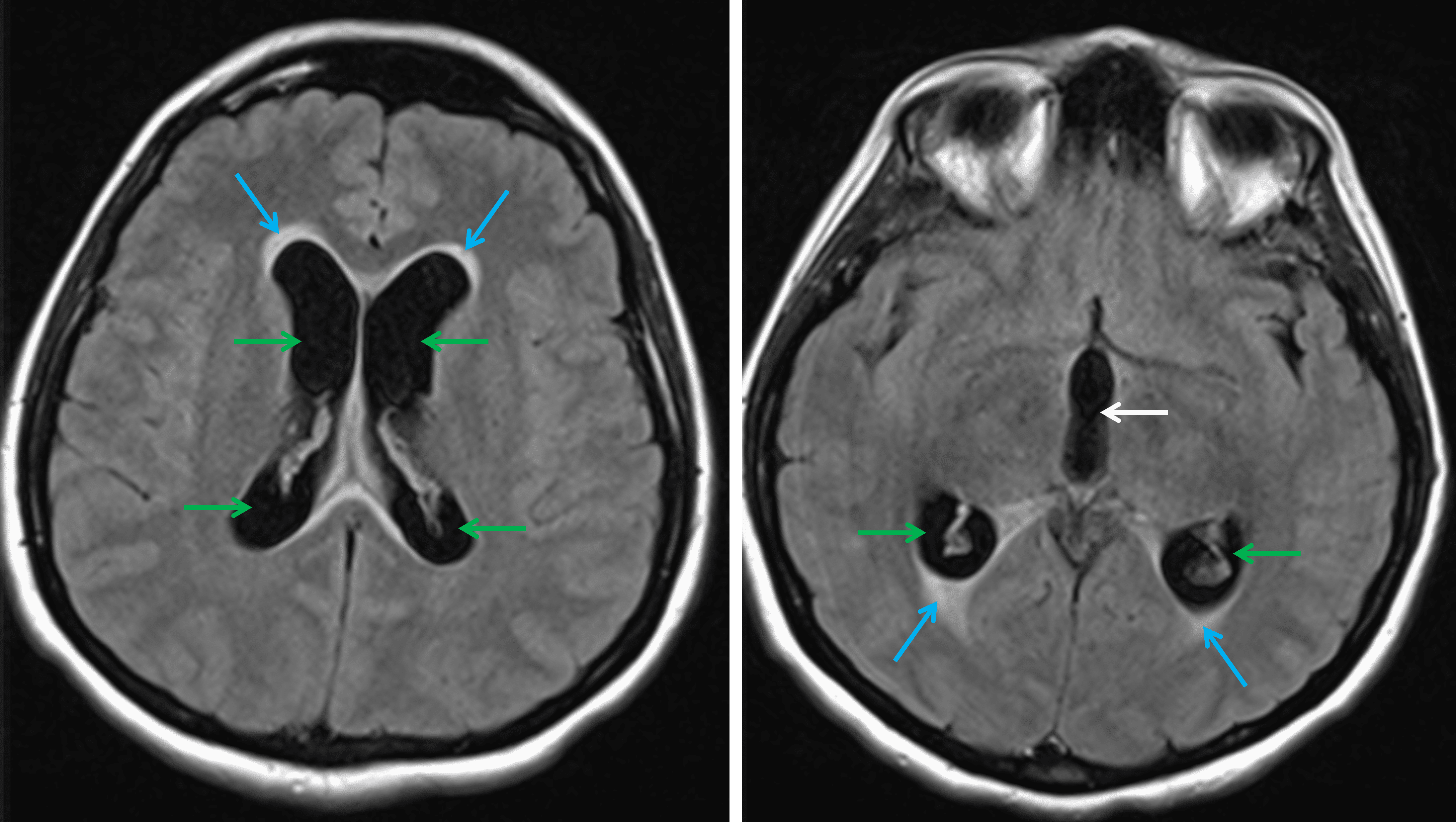 Case #8 - CaseStacks.com