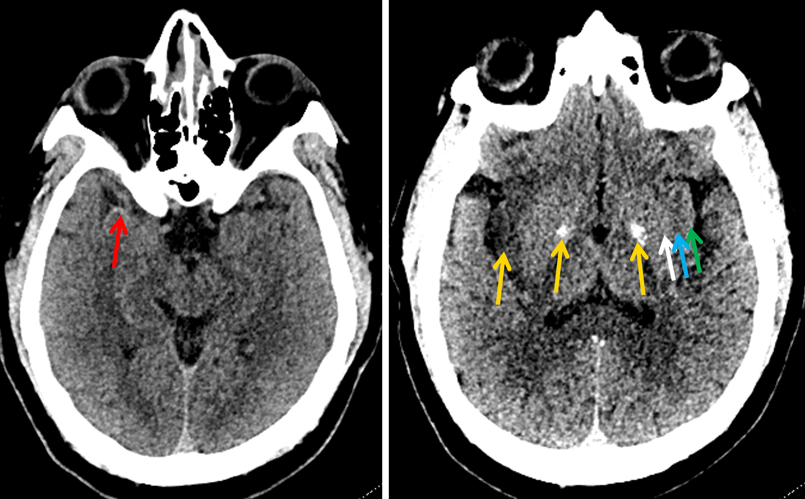 Case #3 - CaseStacks.com